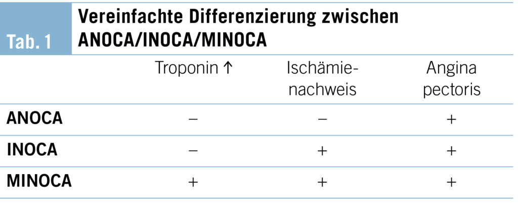 Nicht obstruktive Koronarerkrankungen im Fokus: ­Definition, Diagnostik ...