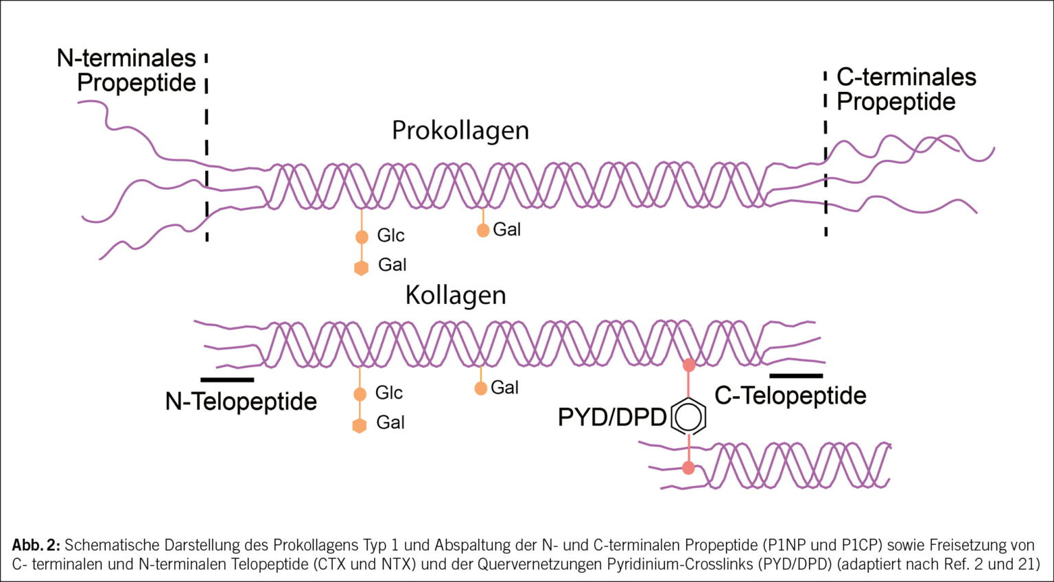 Stellenwert der Knochenumbau-parameter im Management der Osteoporose ...