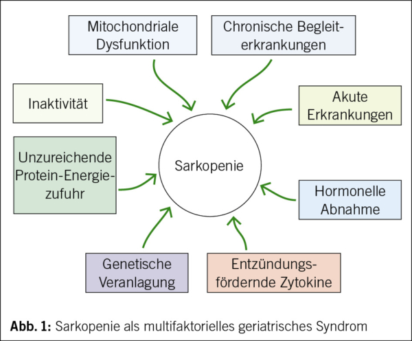 Sarkopenie: erkennen, verstehen, handeln – Aerzteverlag medinfo AG